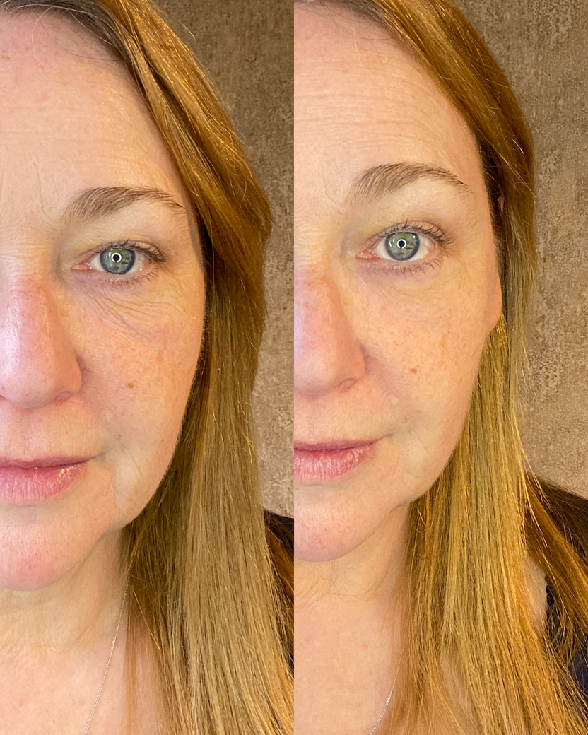 Eyesential under eye enhancer