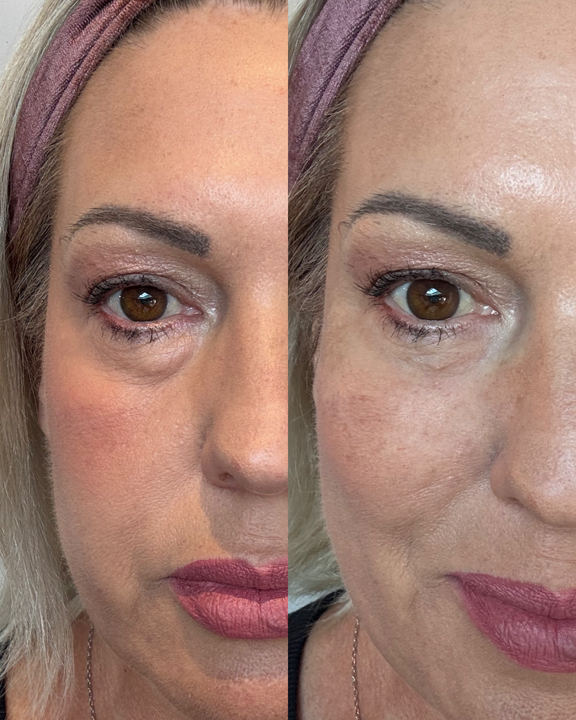 Eyesential under eye enhancer